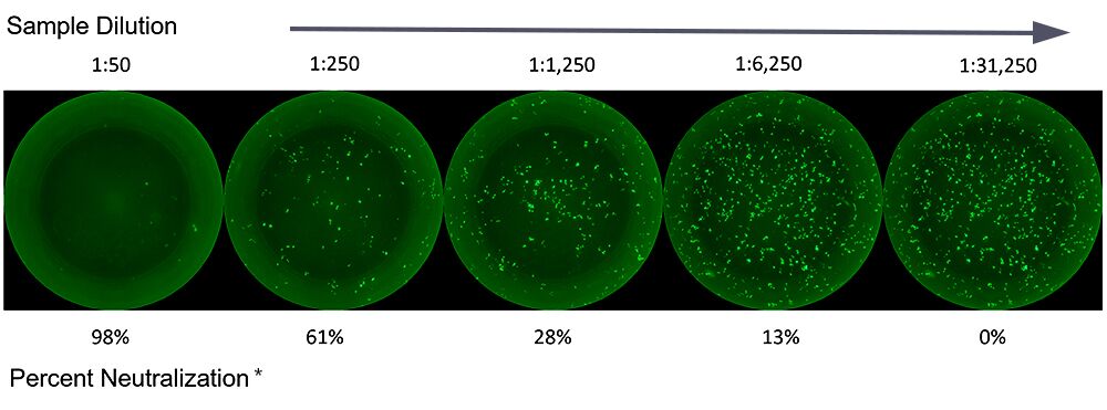 Neutralizing Antibody Assay Services | ImmunoSpot®